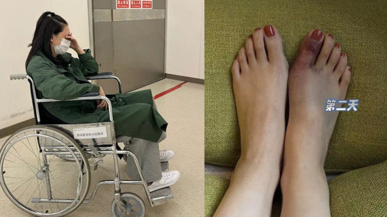 40岁女星被哑铃砸中,脚趾骨折发紫出脓血,强忍4天就医自嘲:蠢毙了腾讯视频