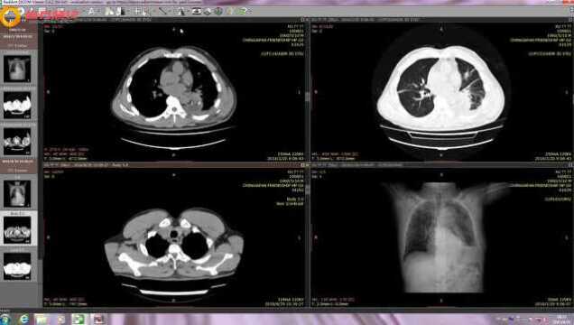 DICOM 图像示例_腾讯视频