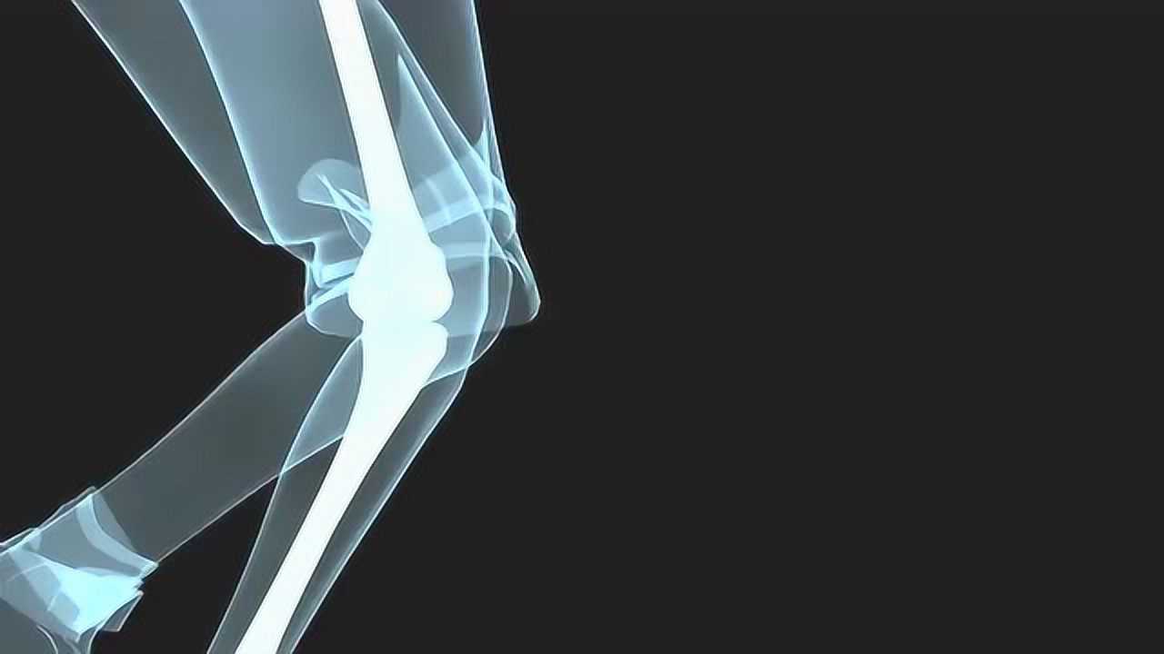 3D重建:ACL手术ACLSurgery_高清1080P在线观看平台_腾讯视频