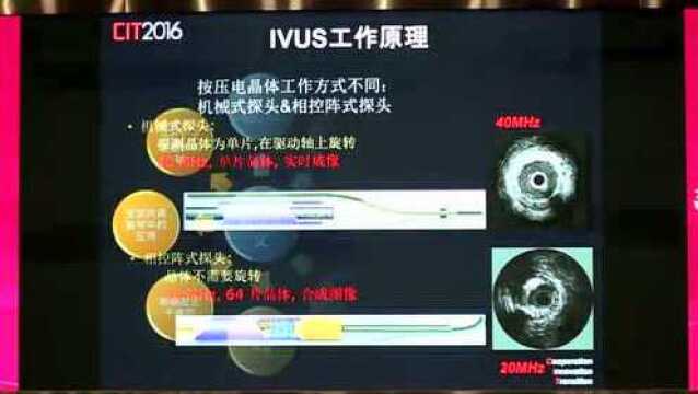 IVUS的临床应用与影像基础_腾讯视频