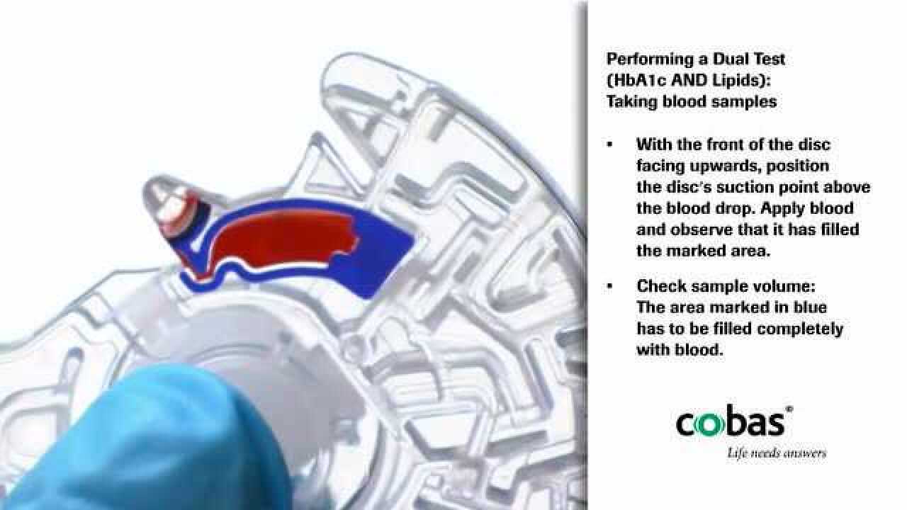 Rochecobasb101离心式微流控系统_高清1080P在线观看平台_腾讯视频