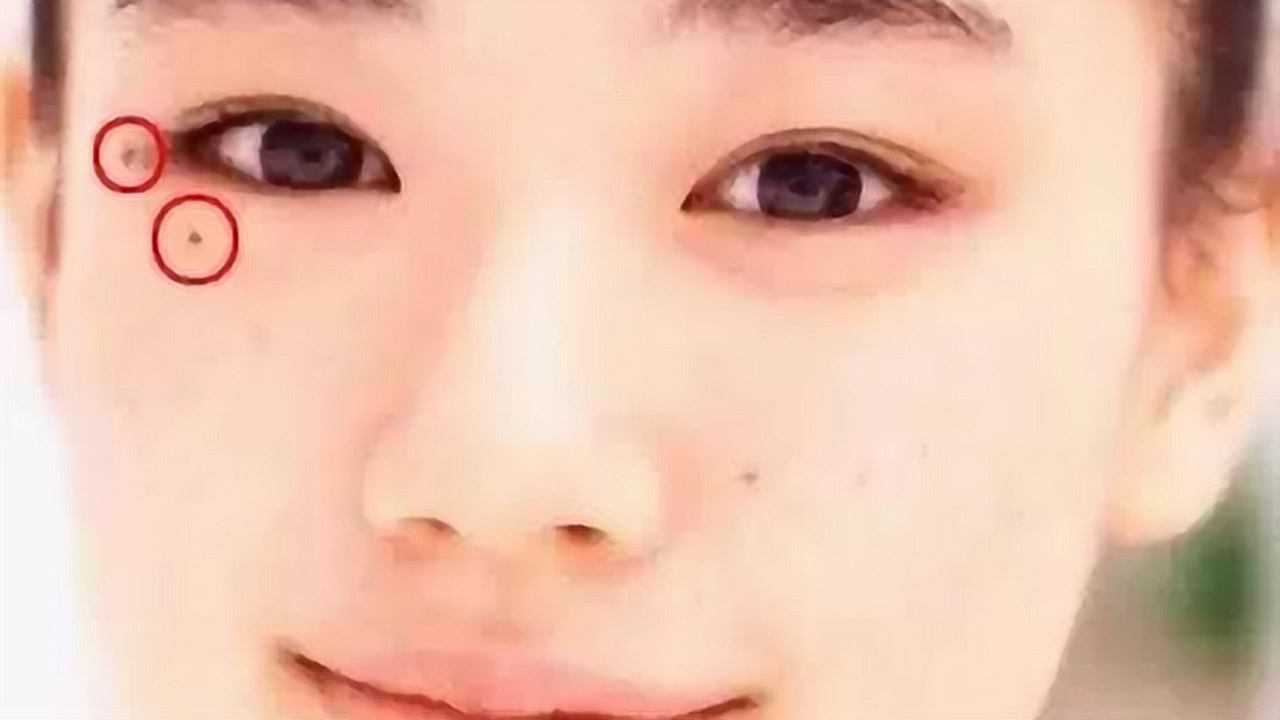 女孩子眼角外侧有黑痣，感情会非常不顺，赶紧点掉吧！_腾讯视频