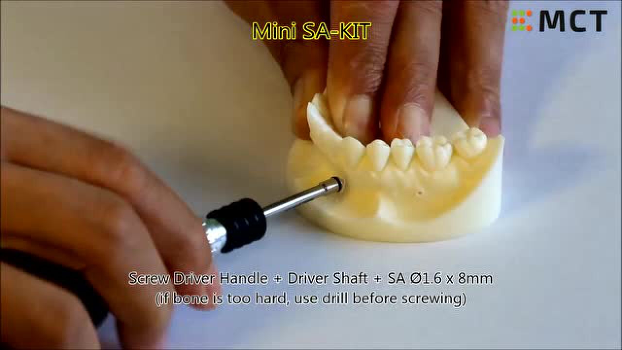 韩国MCT，MSA-KIT_高清1080P在线观看平台_腾讯视频